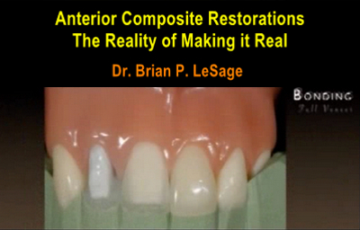 Anterior Composite Restorations: The Reality of Making it Real - Dental ...