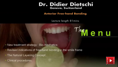 Anterior Free-Hand Bonding - Dental Videos