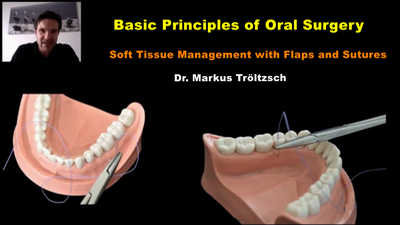 Basic Principles of Oral Surgery: Soft Tissue Management with Flaps and ...