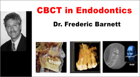 CBCT in Endodontics - Dental Videos