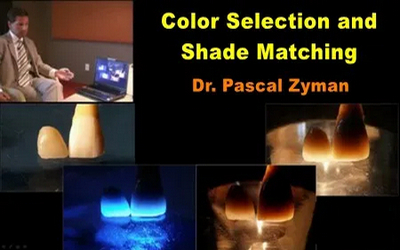 Color Selection and Shade Matching - Dental Videos
