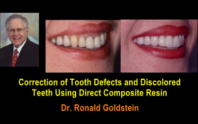 Correction of Tooth Defects and Discolored Teeth Using Direct Composite ...