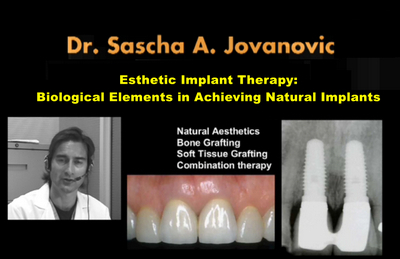 Esthetic Implant Therapy (Dr. Sascha A. Jovanovic) - Dental Videos