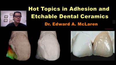 Hot Topics in Adhesion and Etchable Dental Ceramics - Dental Videos