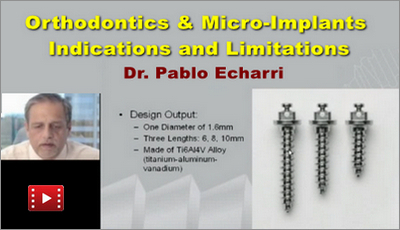 Orthodontics & Micro-Implants: Indications and Limitations - Dental Videos