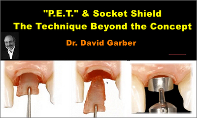 Partial Extraction Therapies & Socket Shield: The Technique Beyond the ...
