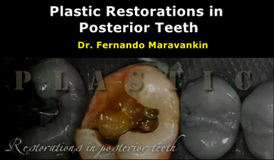 Plastic Restorations in Posterior Teeth - Free Dental Lecture