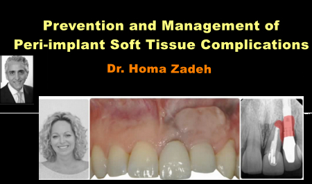 Prevention and Management of Peri-implant Soft Tissue Complications ...