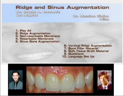 Ridge and Sinus Augmentation - Dental Videos