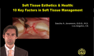 Soft Tissue Esthetics & Health: 10 Key Factors in Soft Tissue ...