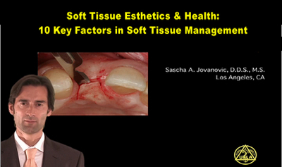 Soft Tissue Esthetics & Health: 10 Key Factors in Soft Tissue ...