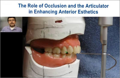 The Role of Occlusion and the Articulator in Enhancing Anterior ...
