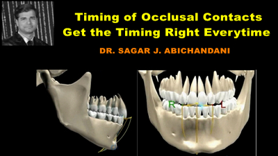 Timing of Occlusal Contacts: Get the Timing Right Everytime - Dental Videos