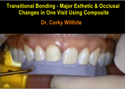 Transitional Bonding: Major Esthetic & Occlusal Changes in One Visit ...