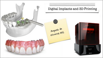 Digital Implantology and 3D Printing - Dental Videos