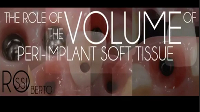 The Role Of The Volume Of Soft Tissue Around Implants - Dental Videos