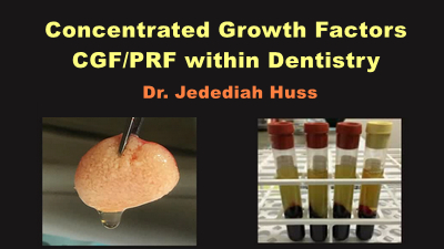 Concentrated Growth Factors: CGF/PRF within Dentistry - Dental Videos