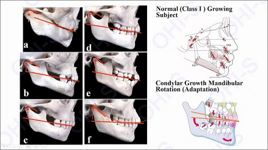 Occlusal Concept (11 Lessons) - Dental Videos