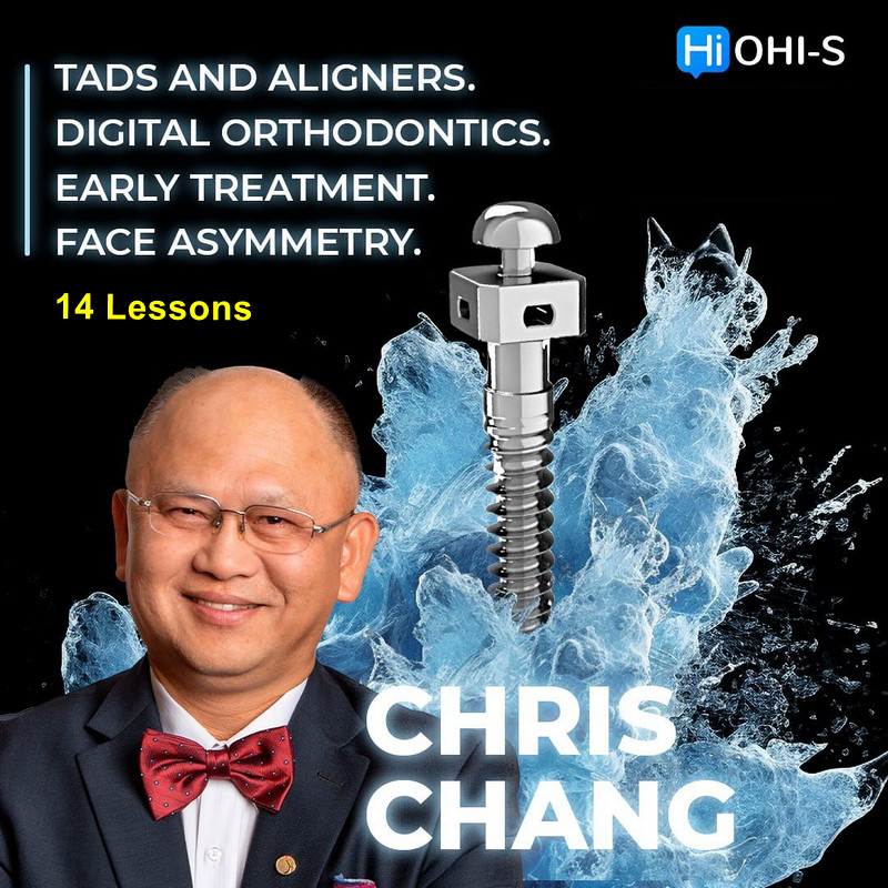 TADs and aligners. Digital orthodontics. Early treatment. Face asymmetry - Dental Videos