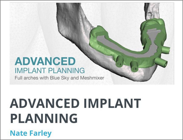 Advanced Implant Planning Course (Full Arch with Blue Sky and Meshmixer ...