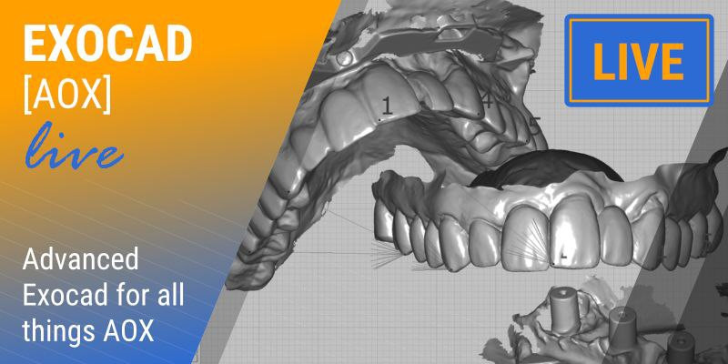 Advanced EXOCAD for all things AOX (EXOCAD AOX) - Dental Videos