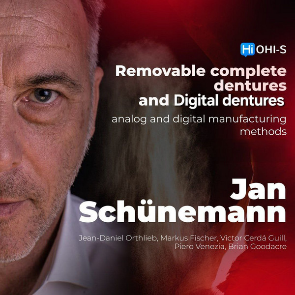 Removable Complete Dentures and Overdentures - Dental Videos